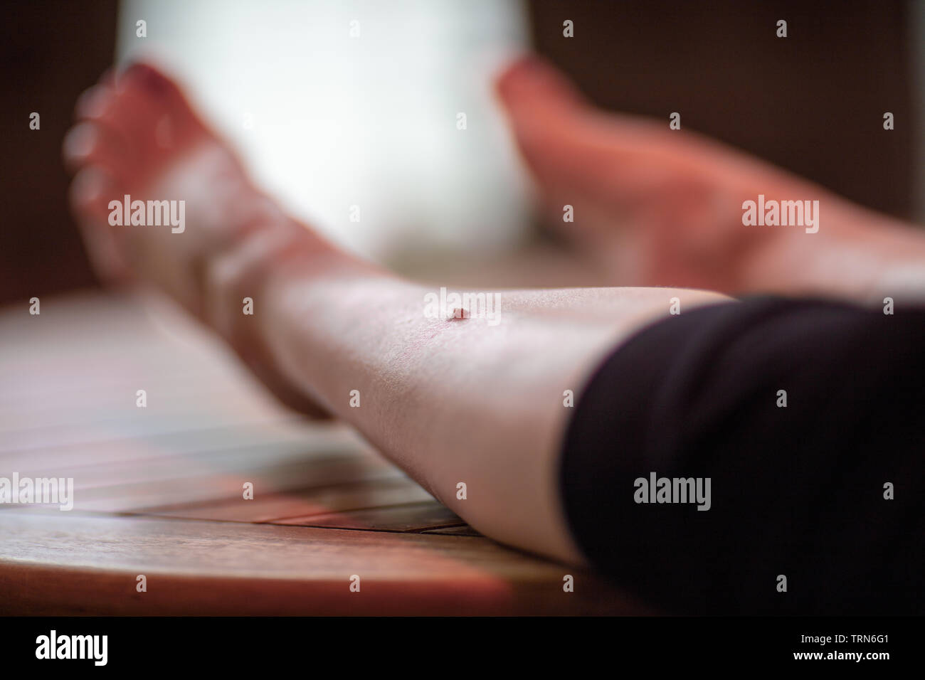 Callus culture hi-res stock photography and images - Alamy