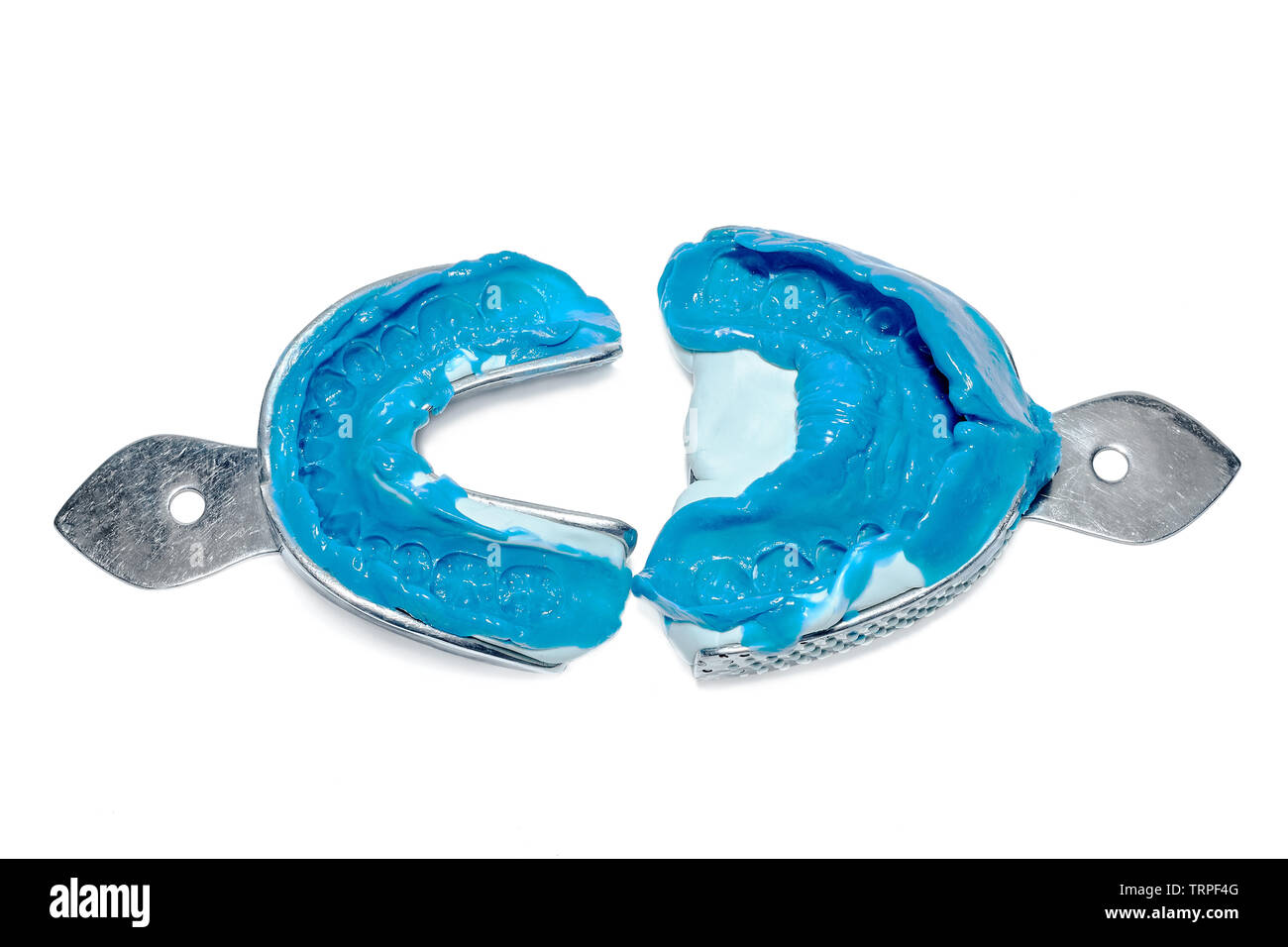 Two dental impressions on a white background. Dental molds from the ...