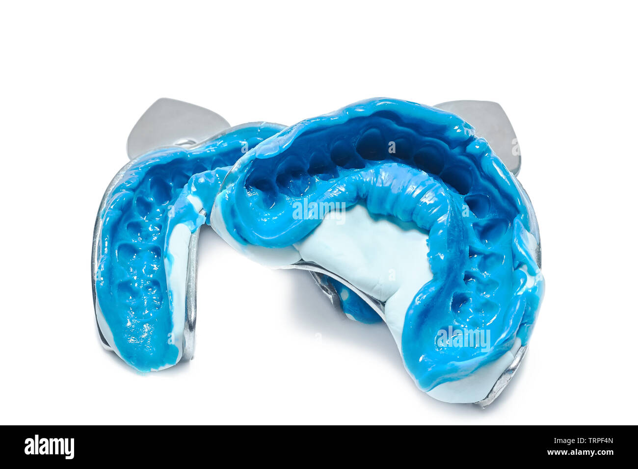 Two dental impressions on a white background. Dental molds from the ...