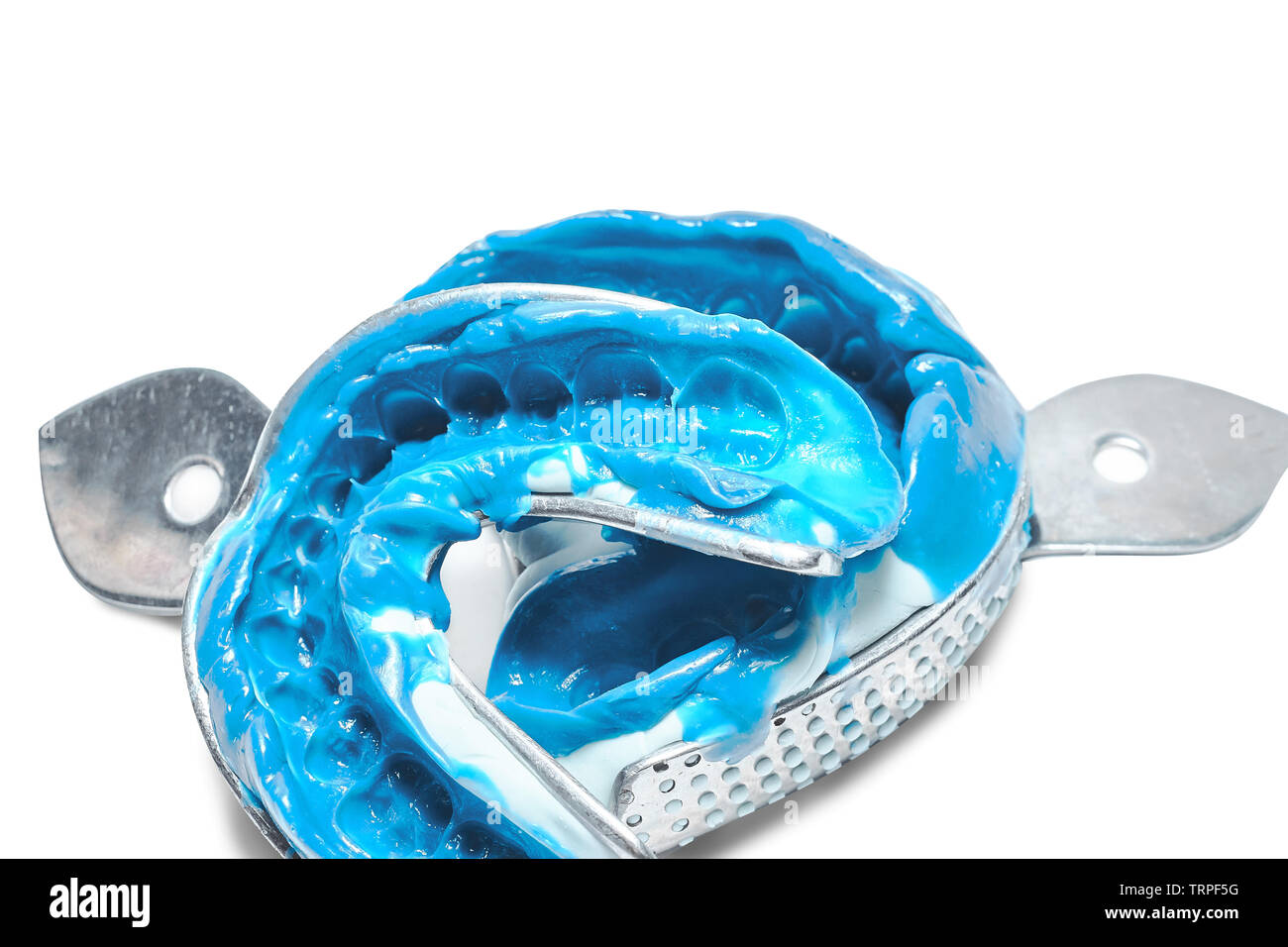 Two dental impressions on a white background. Dental molds from the ...