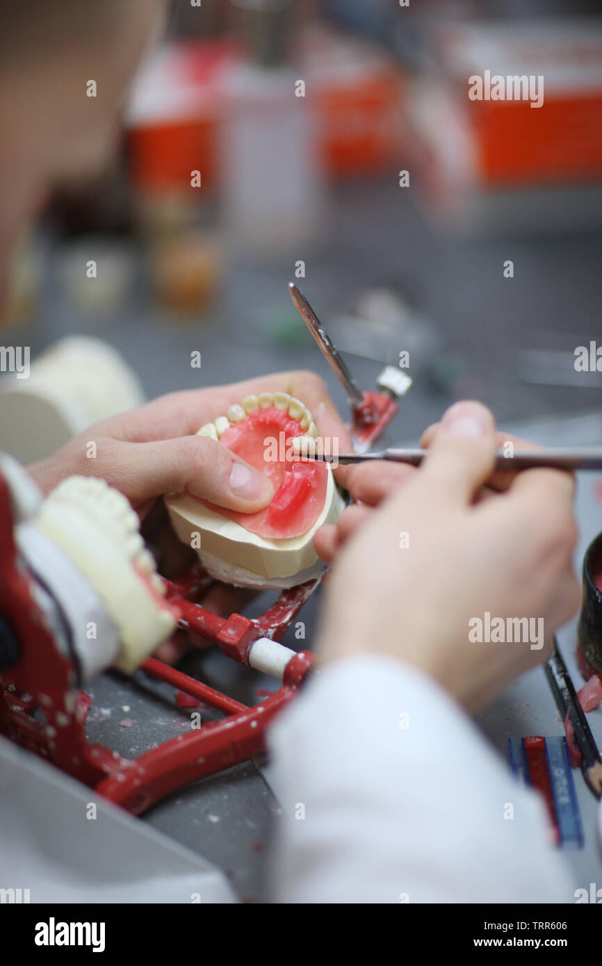 The process of making a dental prosthesis in a dental laboratory Stock ...