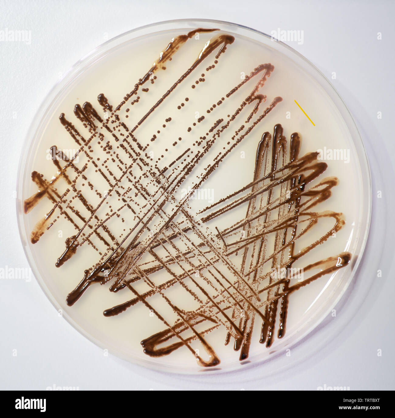 Sowing human feces in a petri dish Stock Photo - Alamy