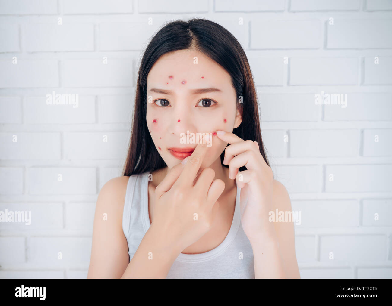 Young Asian woman squeeze acne cheeks problem face looking at mirror ...