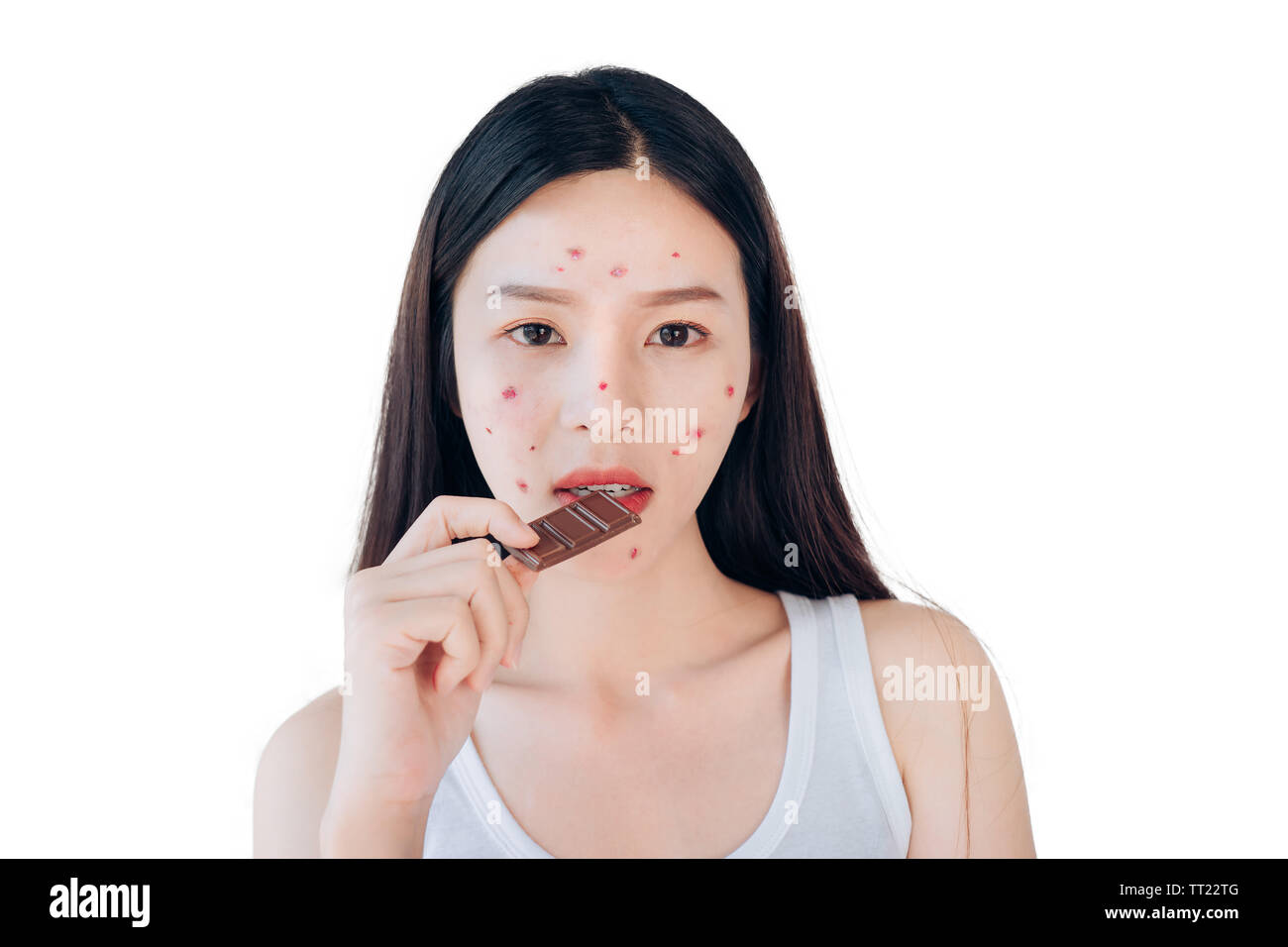 Young Asian woman Acne Problem Face Eating Chocolate bar on white ...