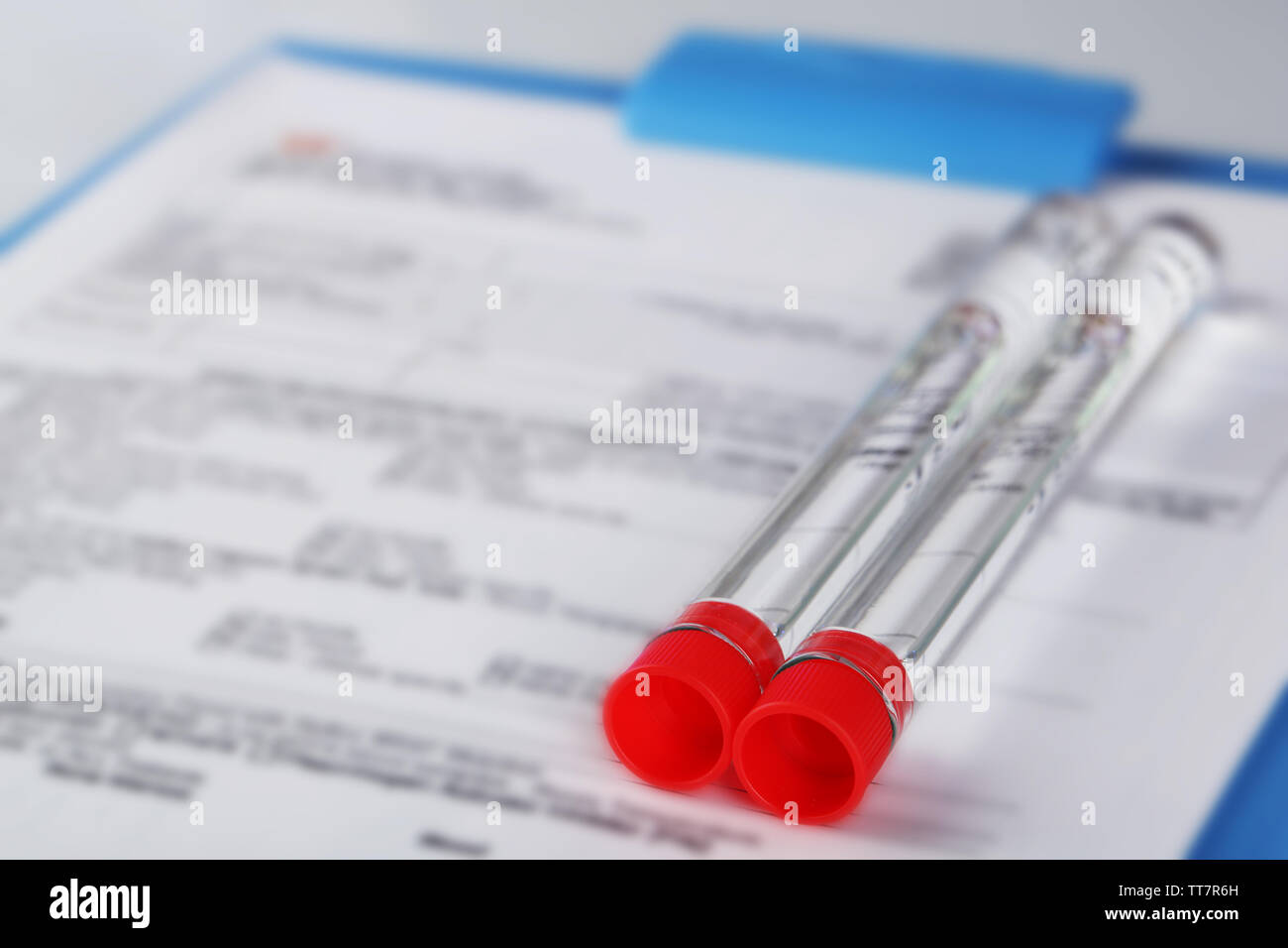 Test tubes and clipboard with medical history form close up Stock Photo ...