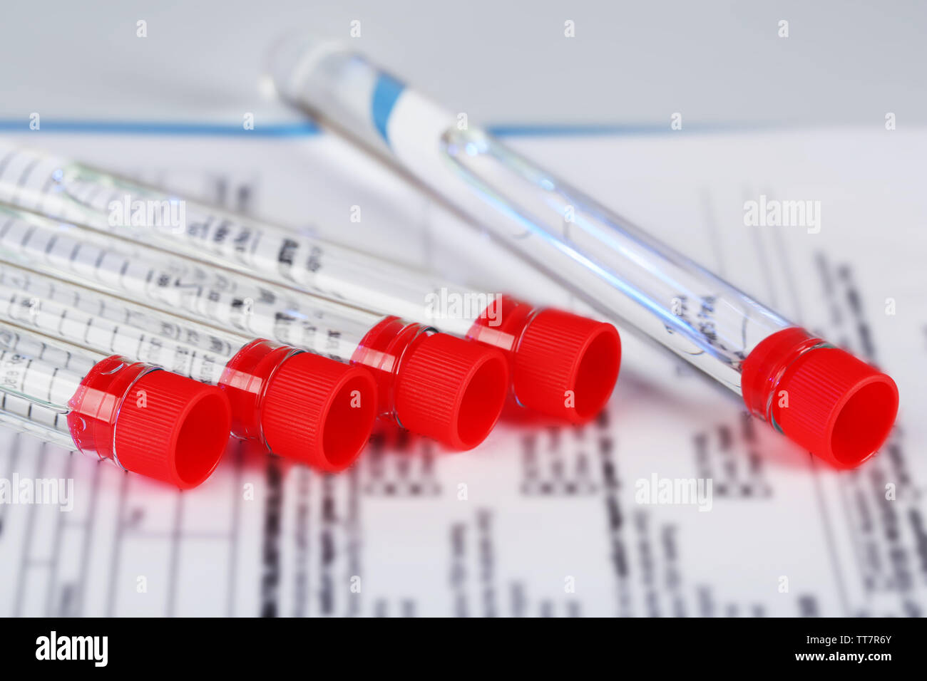 Test tubes and clipboard with medical history form close up Stock Photo ...
