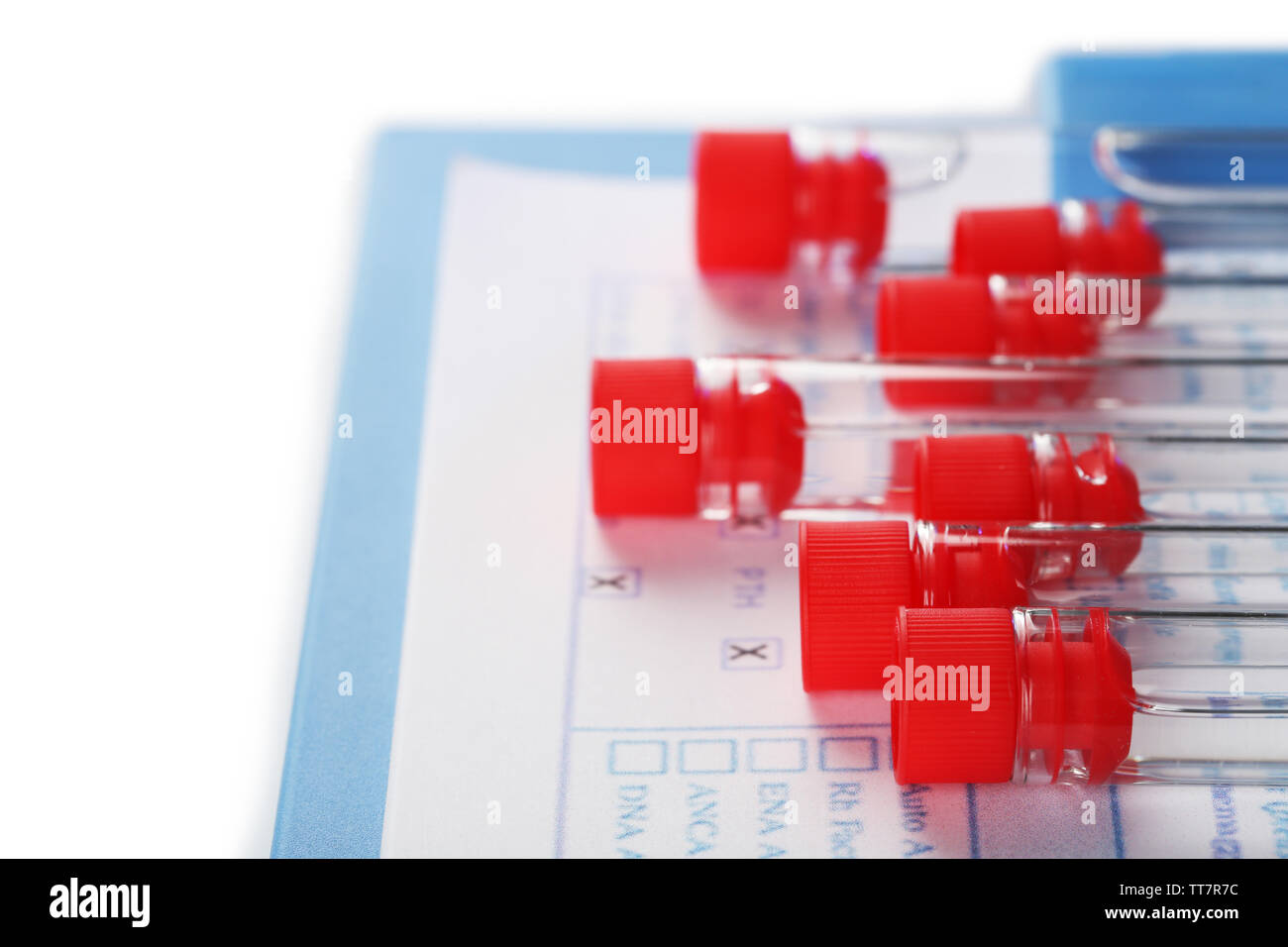 Test tubes and clipboard with medical history form close up Stock Photo ...