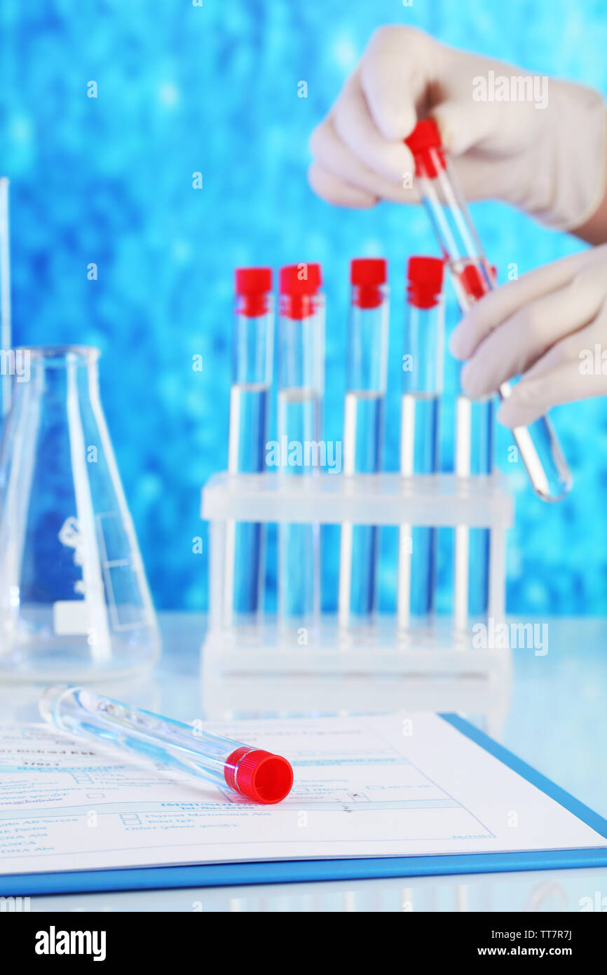 Hand holding test tubes and clipboard with medical history form on ...