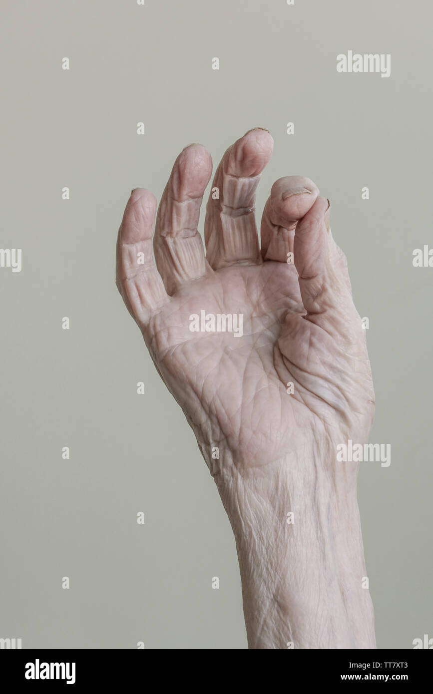 closeup wrinkled hand of a senior person Stock Photo - Alamy