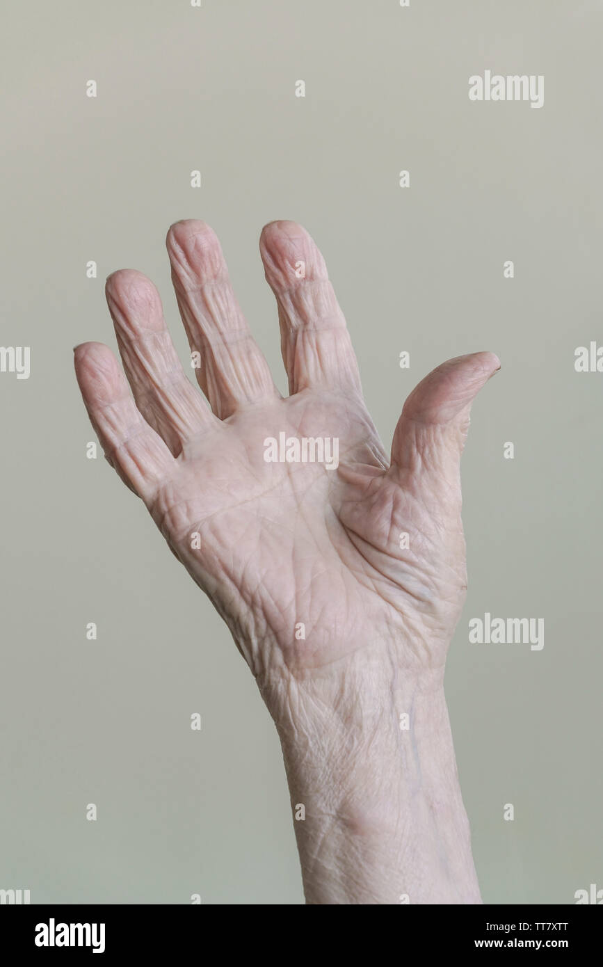 closeup wrinkled hand of a senior person Stock Photo - Alamy