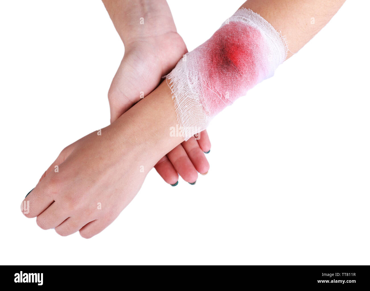 Elastic bandage hand Cut Out Stock Images & Pictures - Alamy