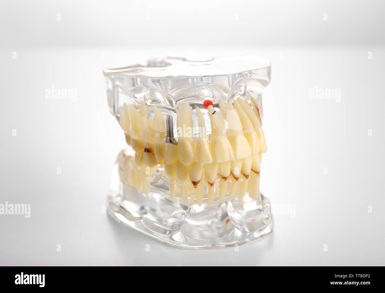 Plastic human teeth models isolated on white Stock Photo - Alamy