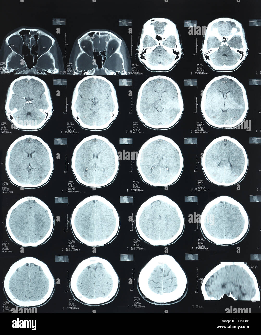 Internal organs x ray hi-res stock photography and images - Alamy