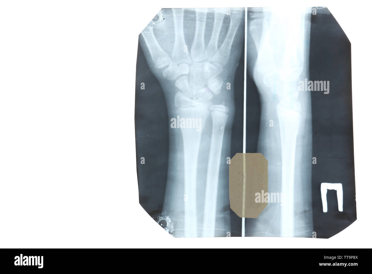 Skeleton arm on black Cut Out Stock Images & Pictures - Alamy