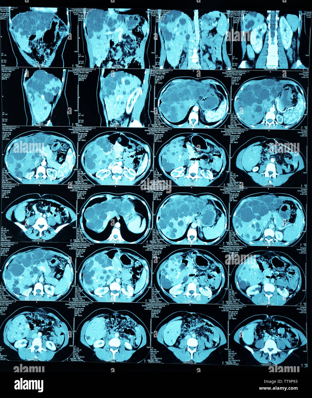 X-ray scanner of internal organs isolated on white Stock Photo - Alamy