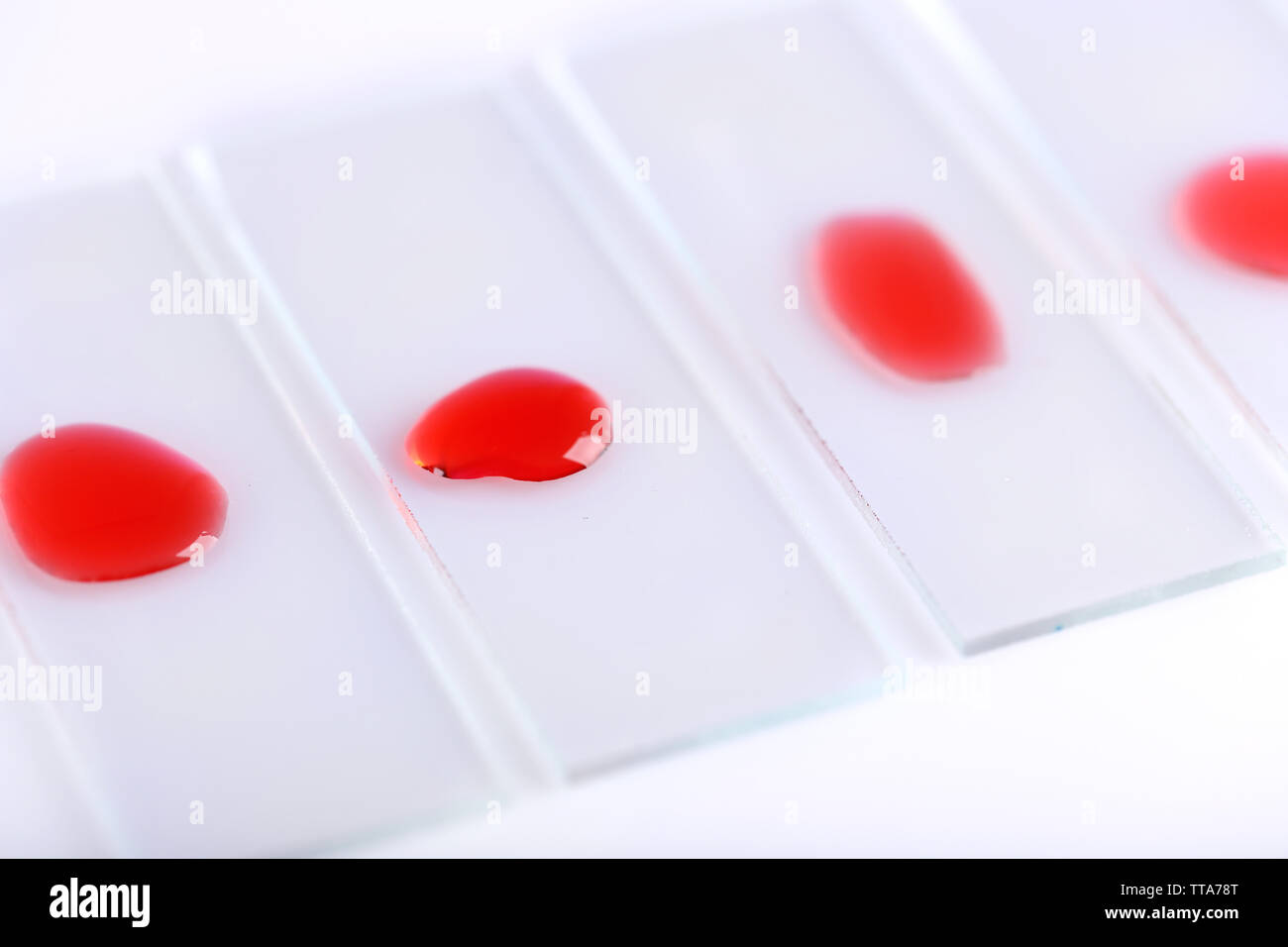 Laboratory analysis of blood close up Stock Photo - Alamy