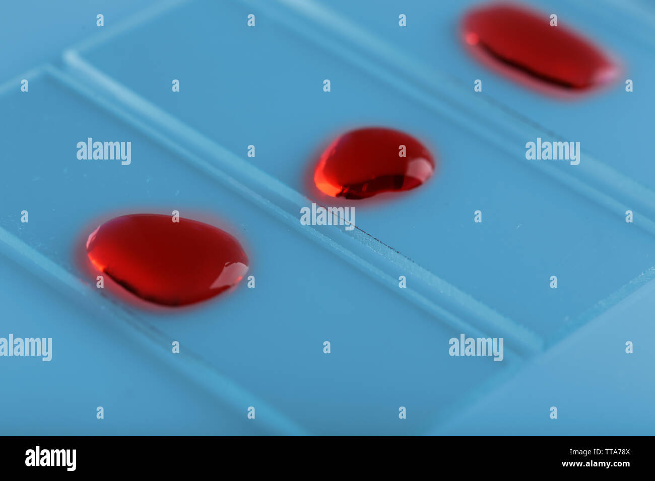 Laboratory analysis of blood close up Stock Photo - Alamy