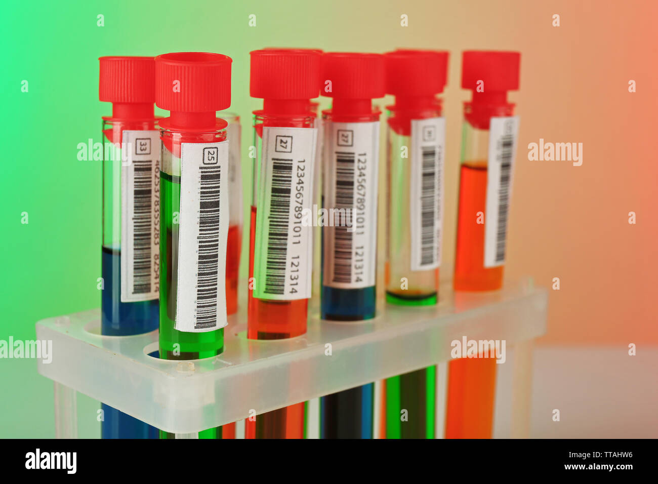 Test tubes with colorful liquid on light color background Stock Photo ...