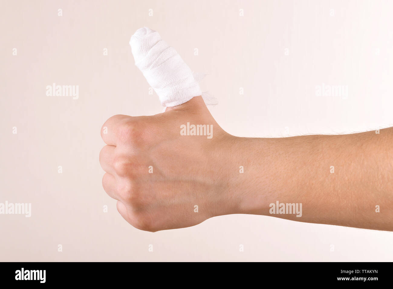 Finger fracture first aid hi-res stock photography and images - Alamy