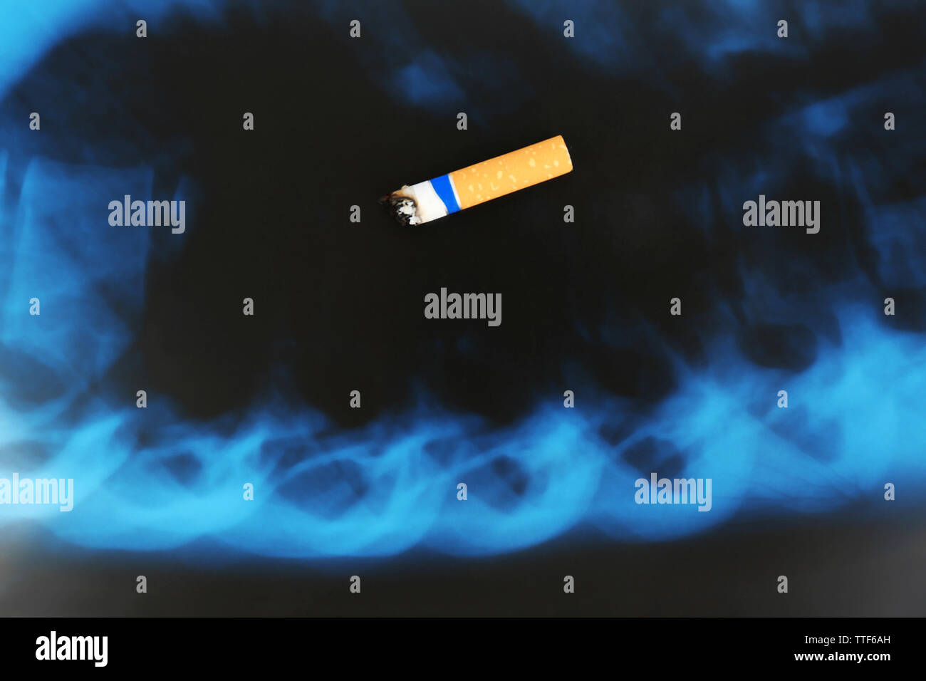 Cigarette on x-ray lung, close up Stock Photo - Alamy