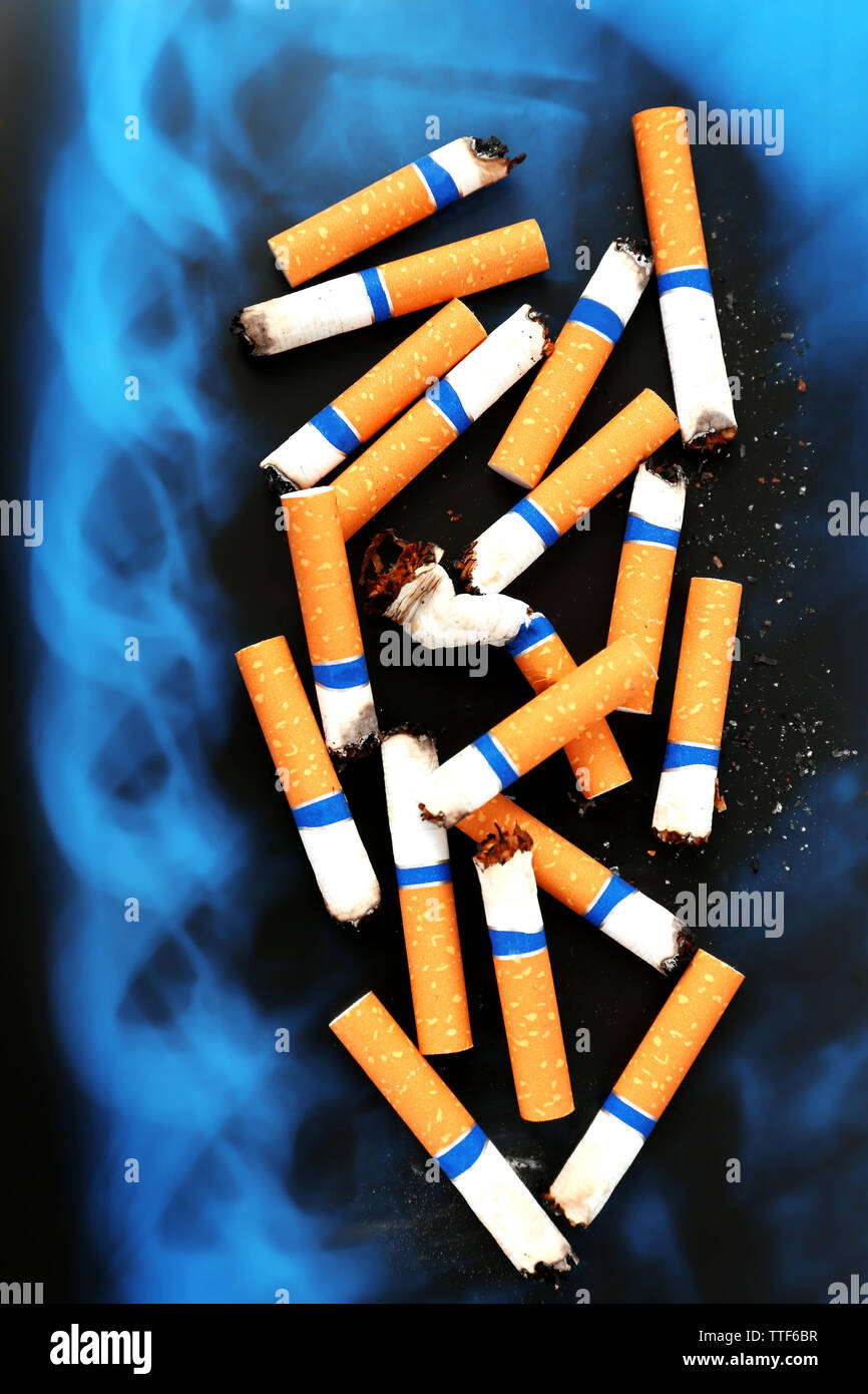 Cigarettes on x-ray lung, close up Stock Photo - Alamy