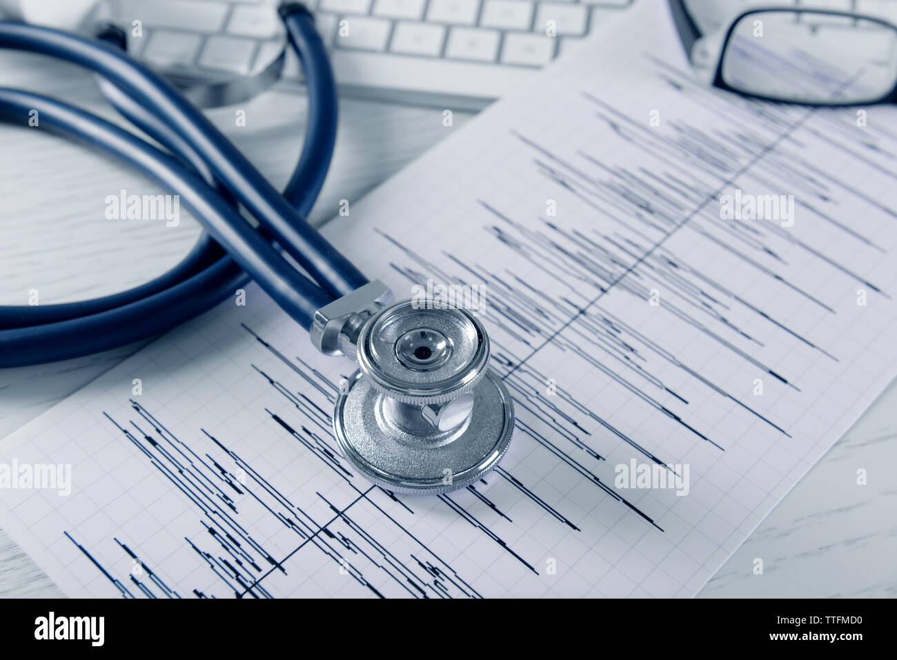 Cardiogram chart with medical stethoscope on table closeup Stock Photo ...