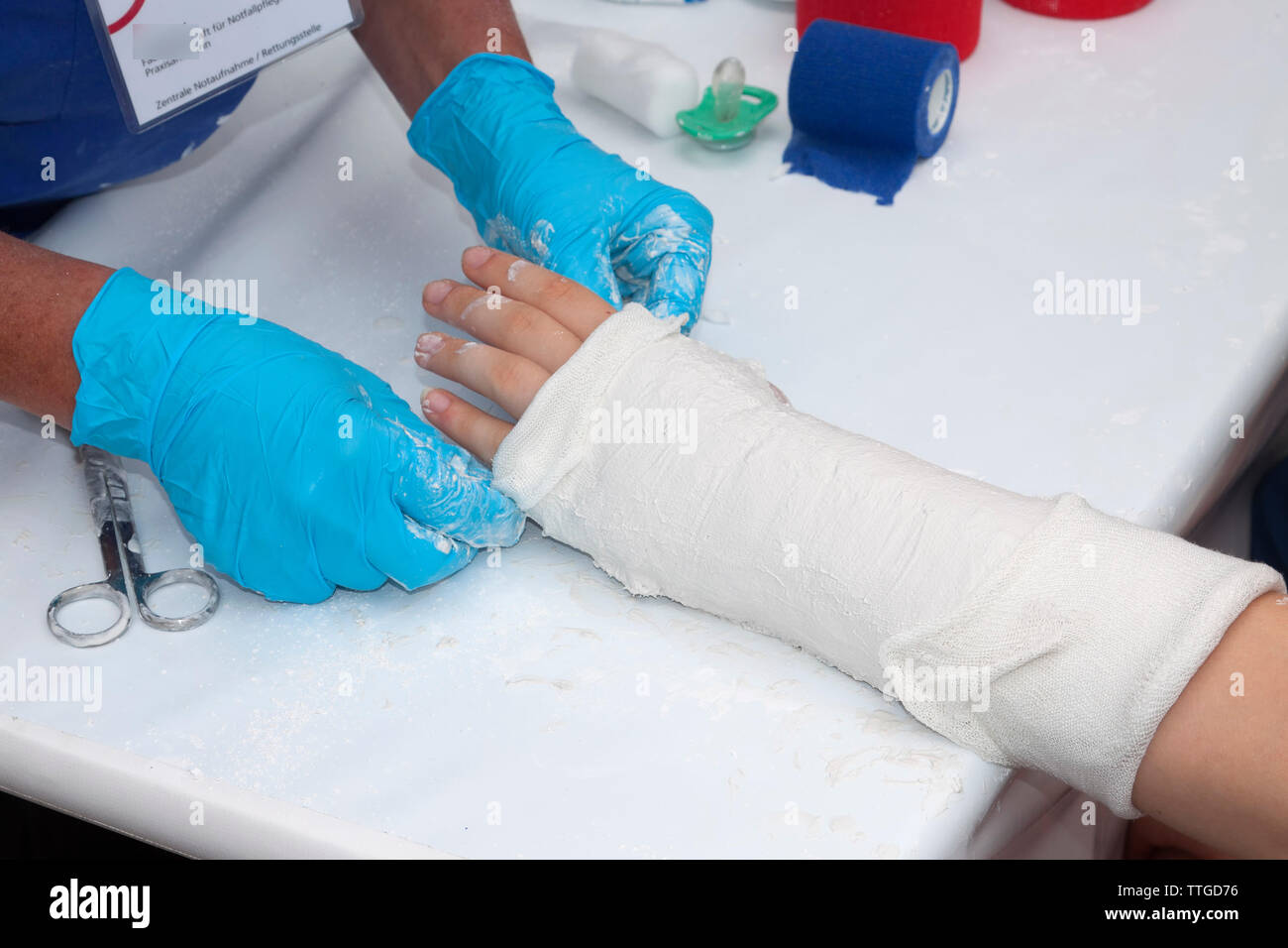 To cast a plaster of paris bandage hi-res stock photography and images ...