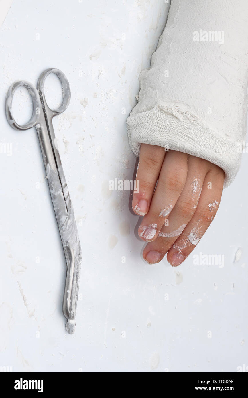 Woman In Plaster Cast High Resolution Stock Photography and Images - Alamy