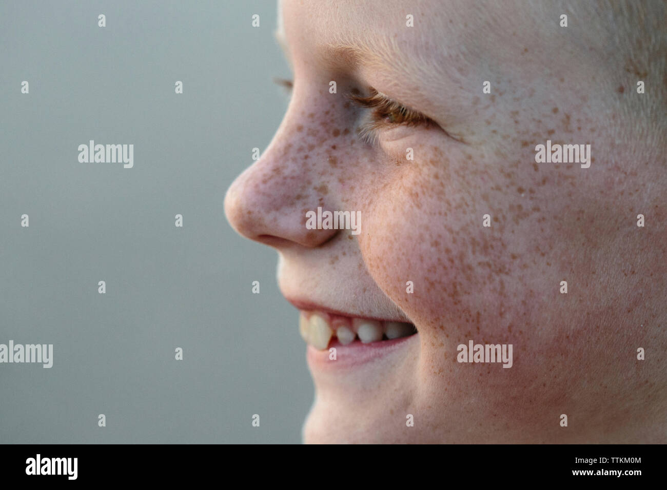 Boy face freckles hi-res stock photography and images - Alamy