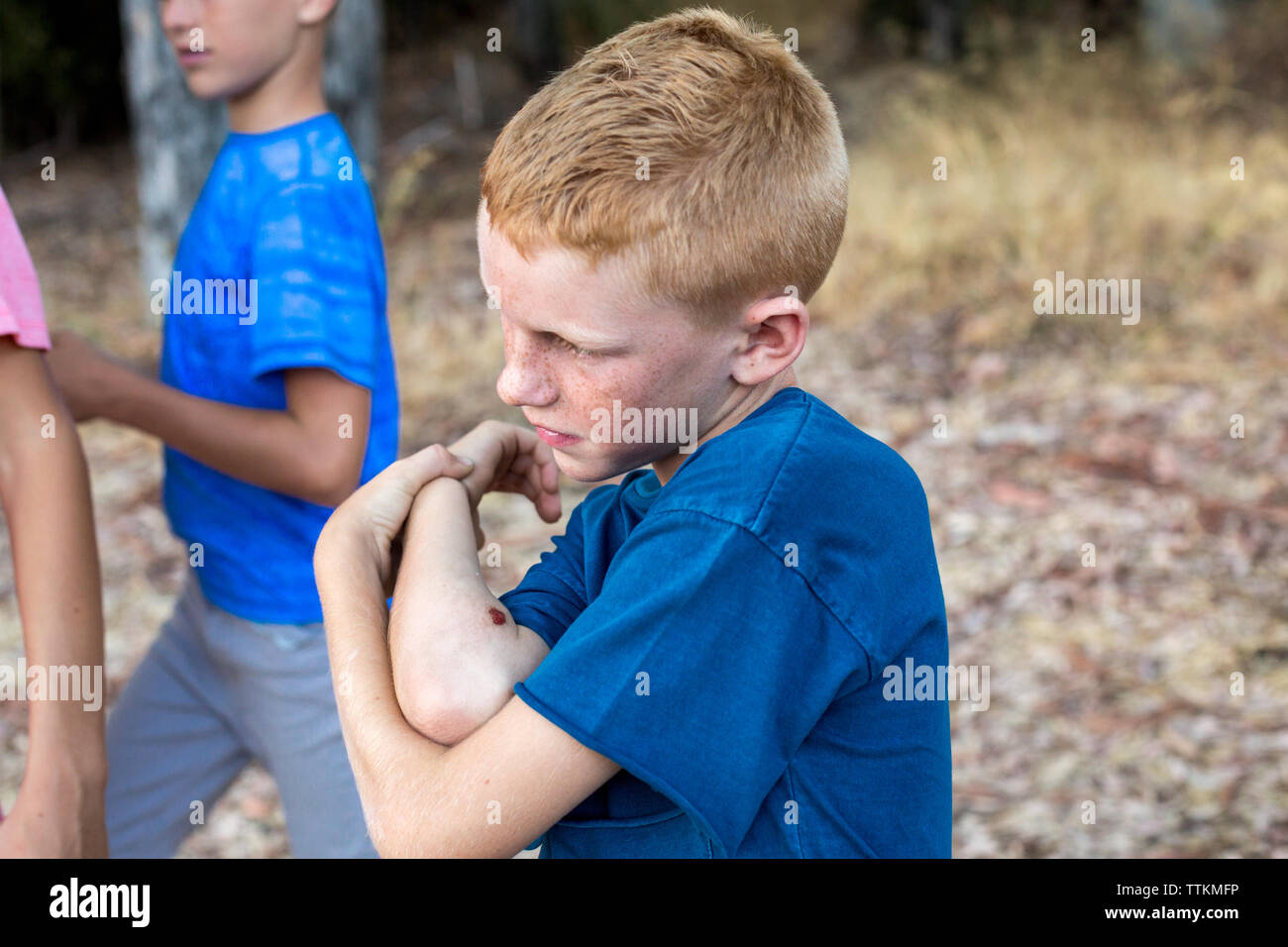Boy with blood hi-res stock photography and images - Alamy