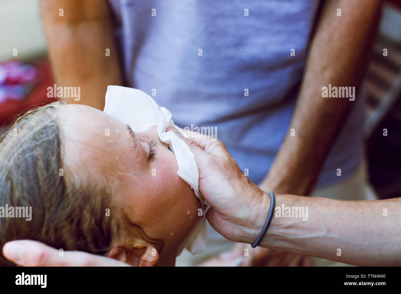 Bleeding nose hi-res stock photography and images - Alamy