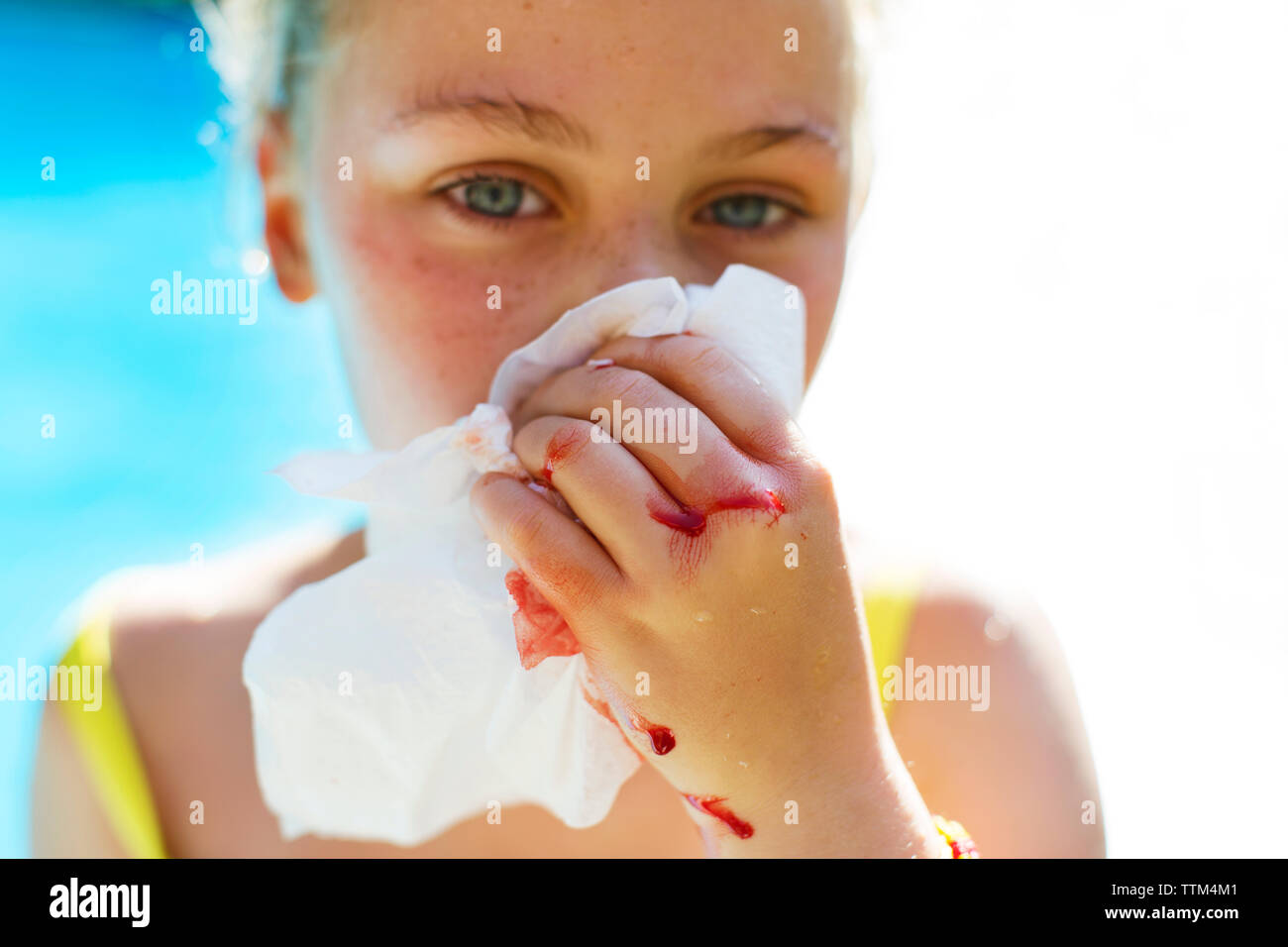 Blood bleeding hand hi-res stock photography and images - Alamy