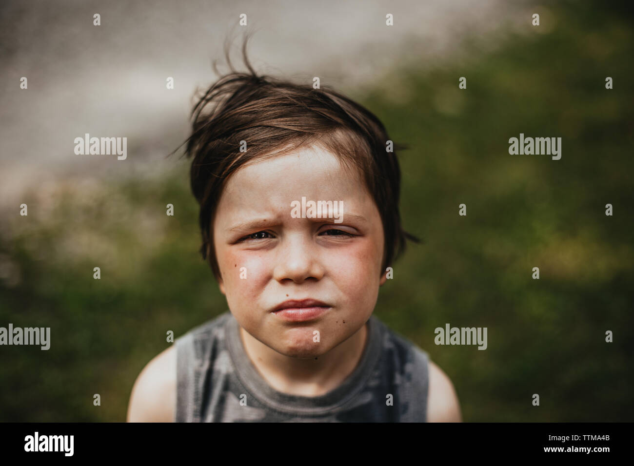 an unhappy boy has a bug bite on his eye Stock Photo - Alamy