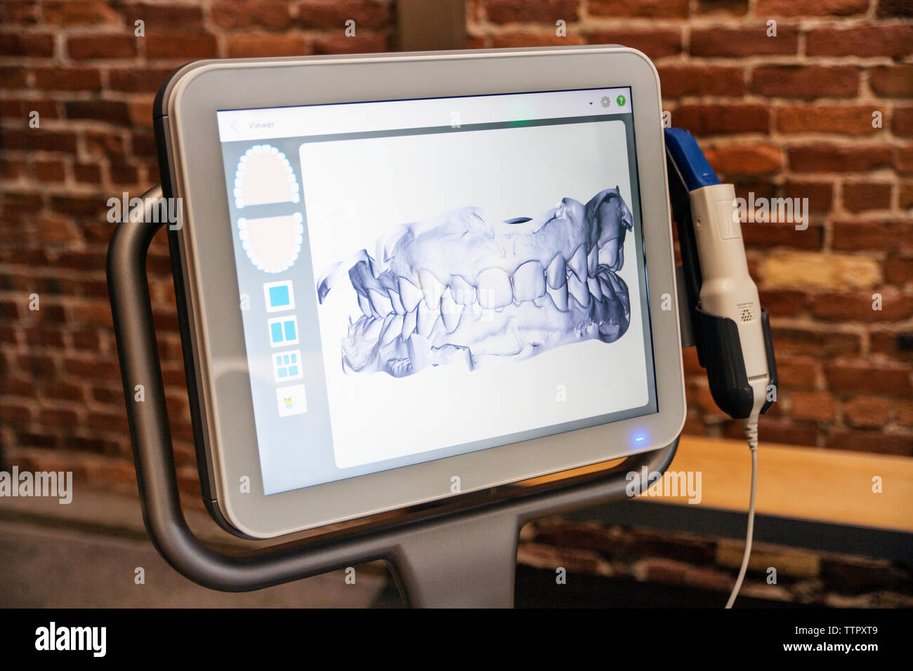 X ray screen hi-res stock photography and images - Alamy