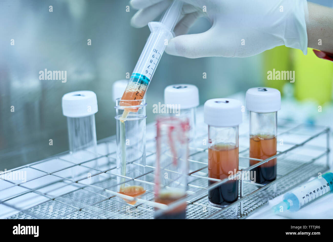hand pouring blood in to plastic bottle, Hospital laboratory Stock ...