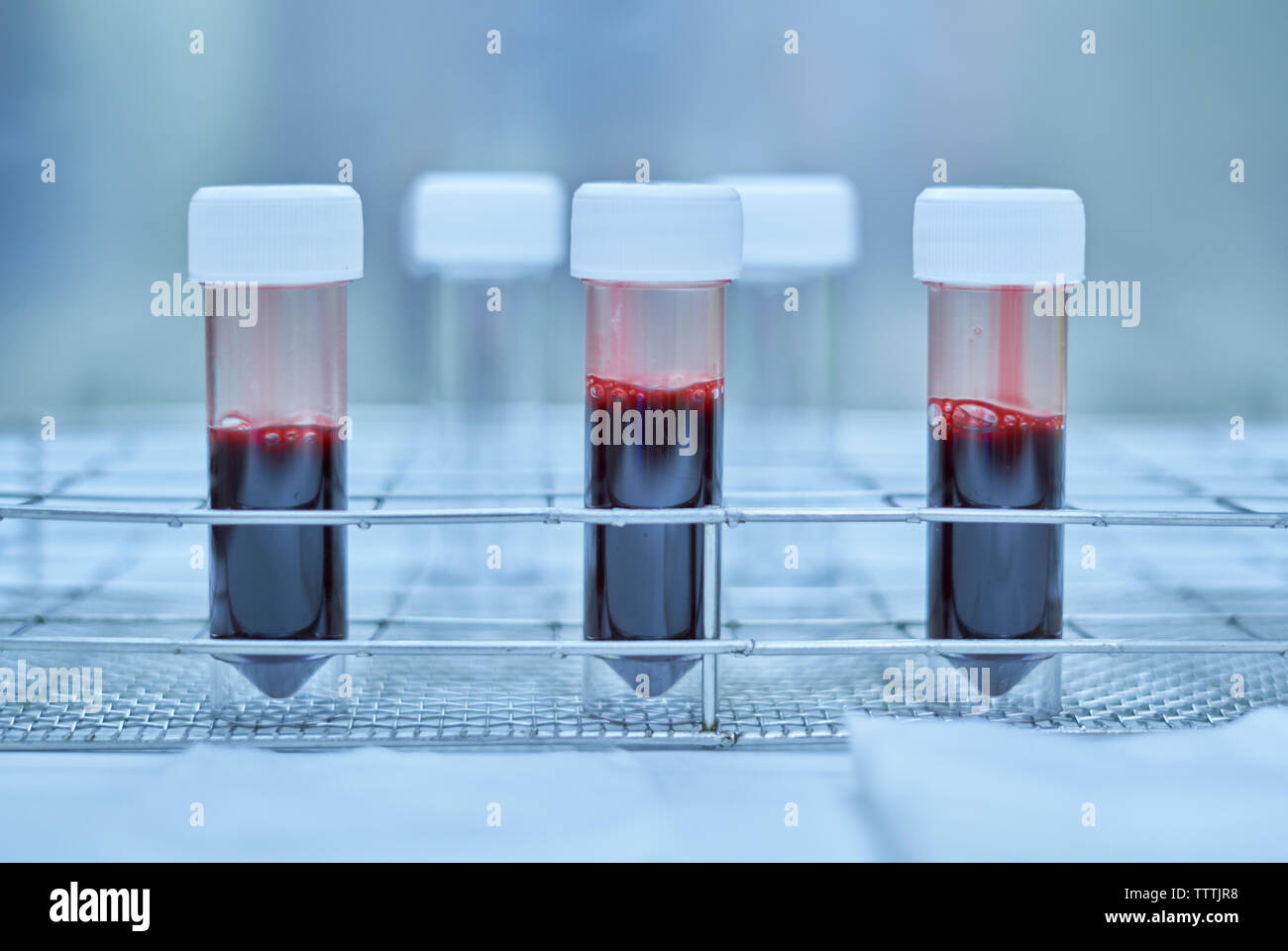 Blood in to plastic bottle, Hospital laboratory Stock Photo - Alamy