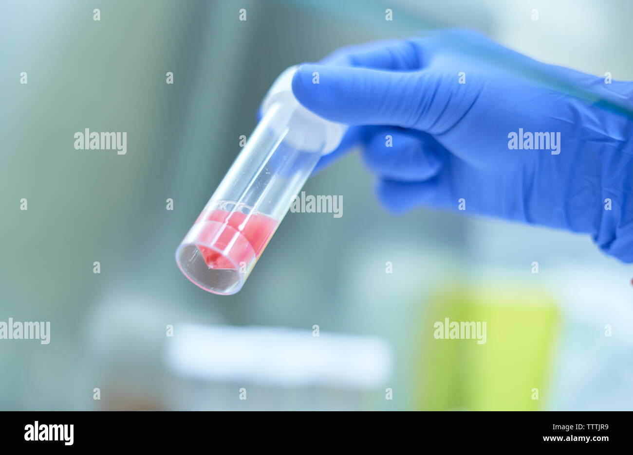 hand pouring blood in to plastic bottle, Hospital laboratory Stock ...