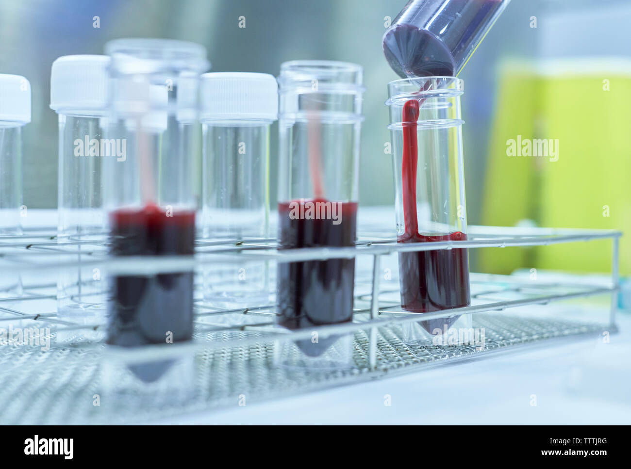 hand pouring blood in to plastic bottle, Hospital laboratory Stock ...