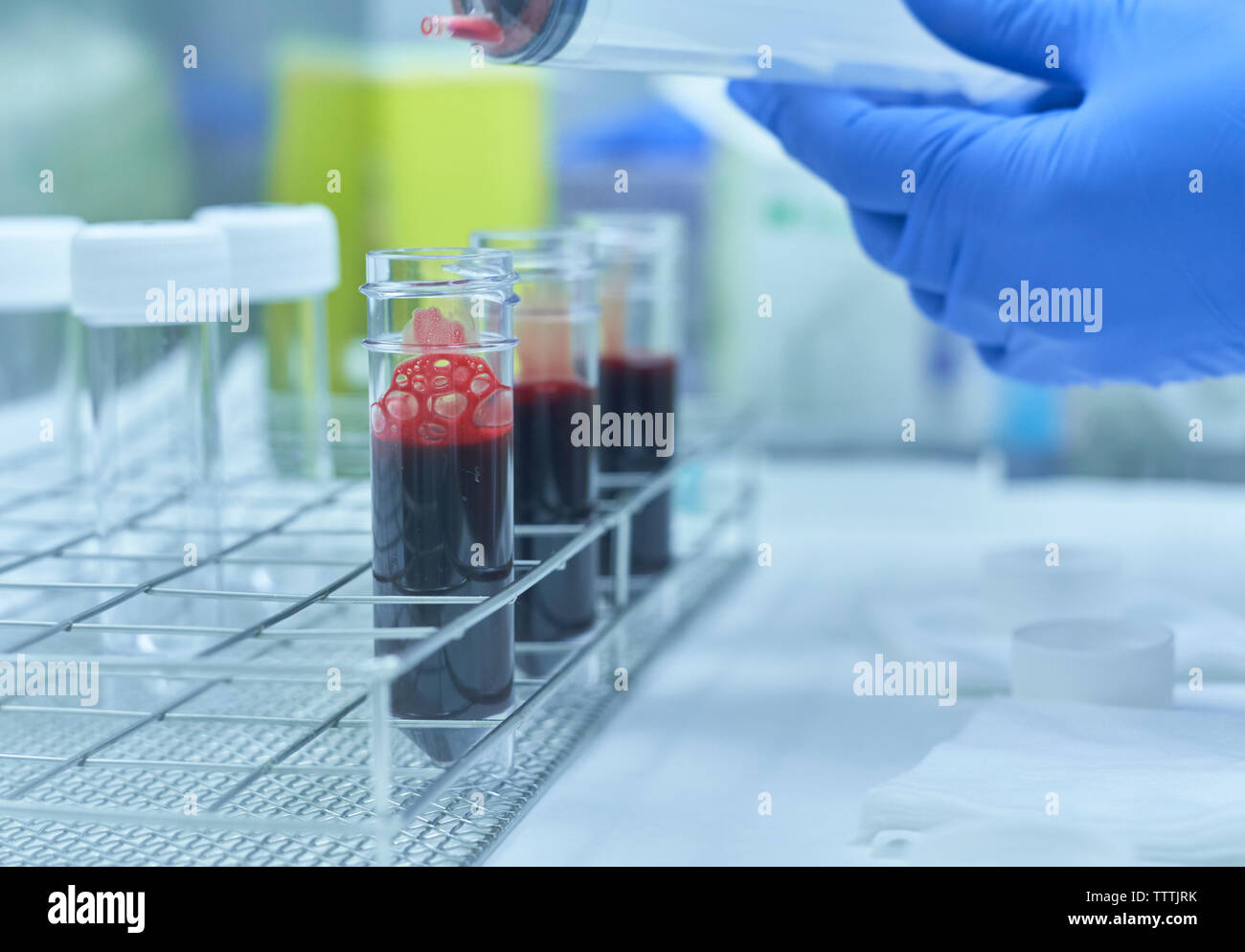 hand pouring blood in to plastic bottle, Hospital laboratory Stock ...