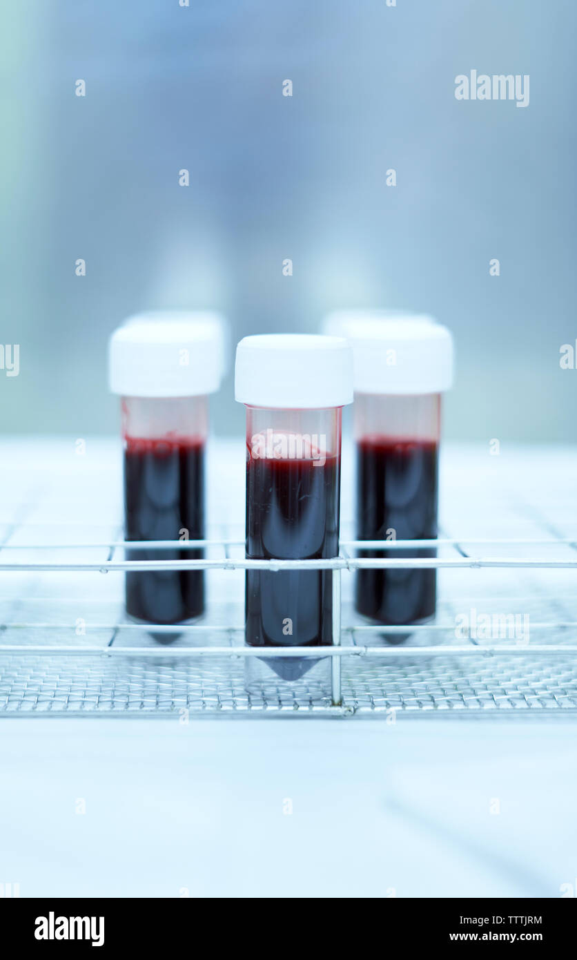 Container blood sample in plastic hi-res stock photography and images ...