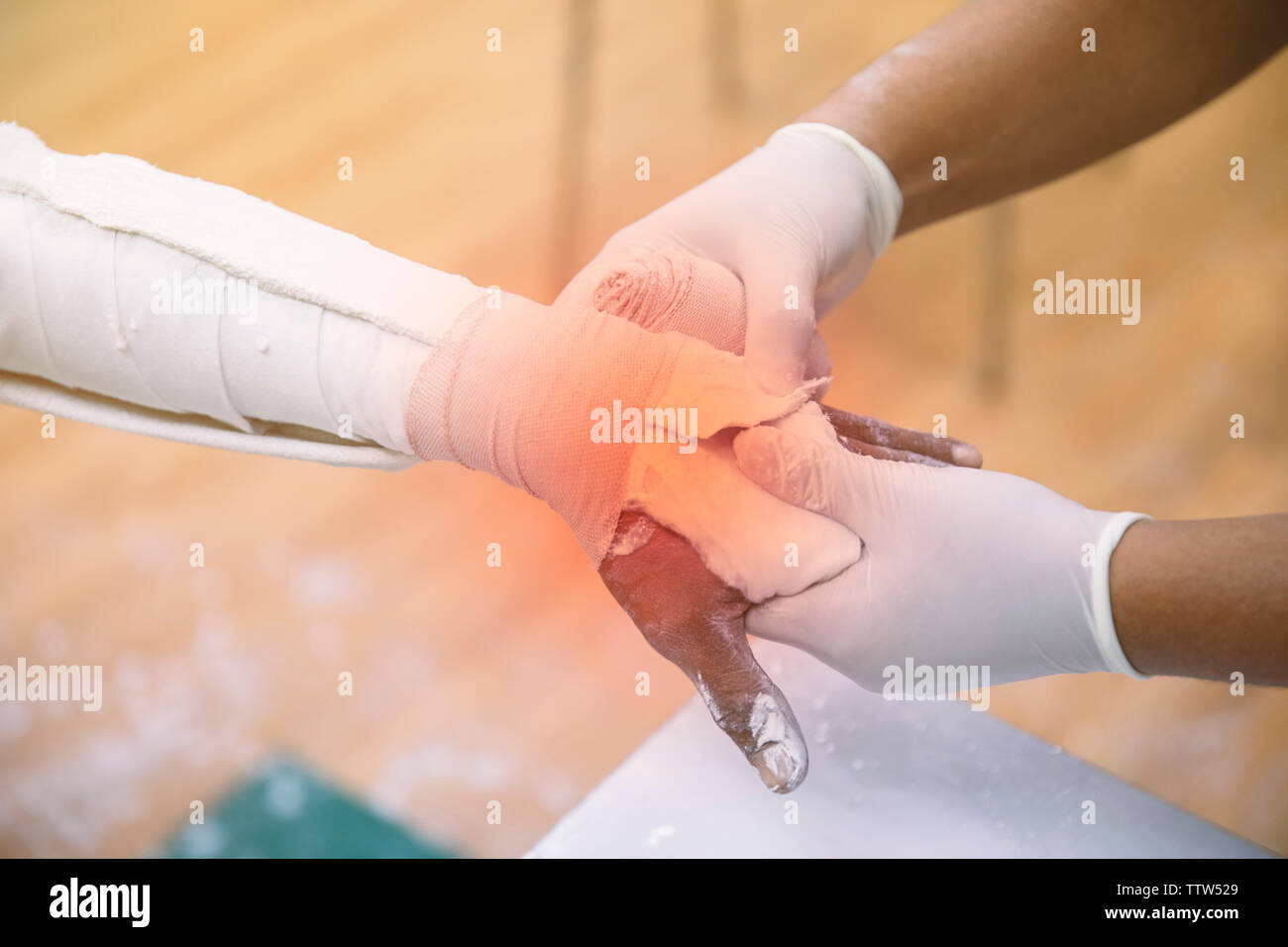 Broken arm cast hi-res stock photography and images - Alamy