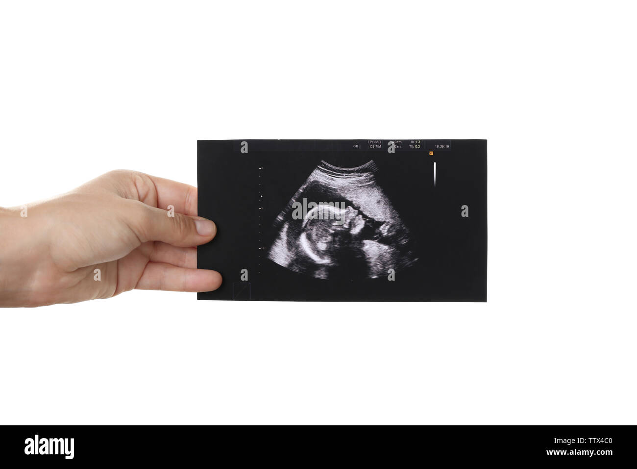 Female hand with ultrasound picture of baby on white background Stock ...