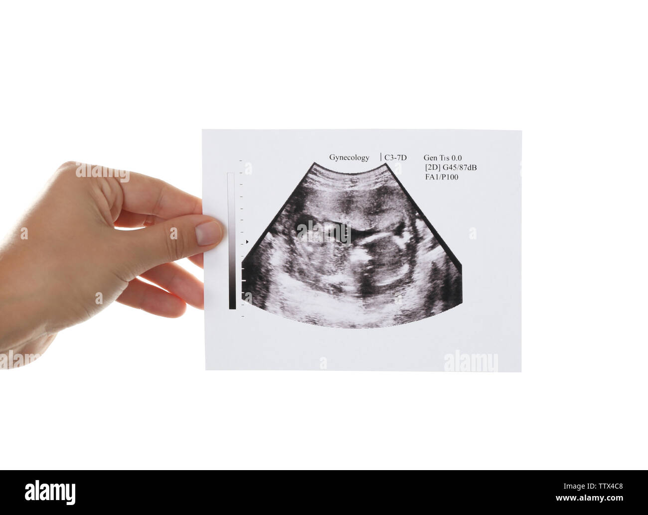 Female hand with ultrasound picture of baby on white background Stock ...