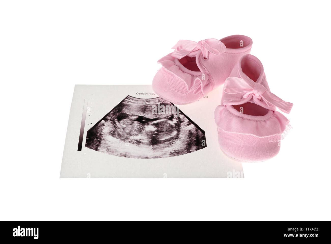 Ultrasound picture of baby and children shoes on white background Stock ...