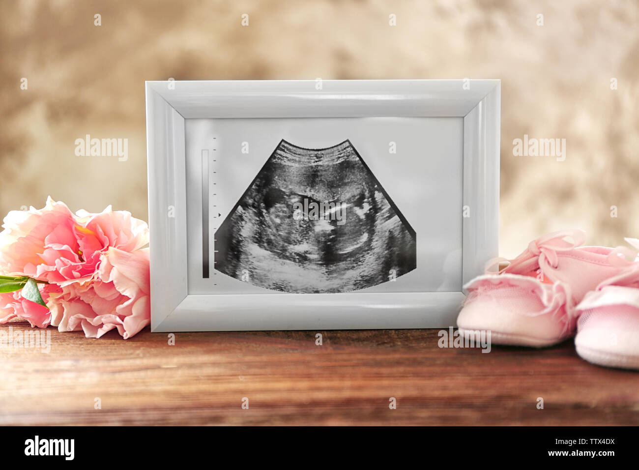 Embryo ultrasound frame hi-res stock photography and images - Alamy