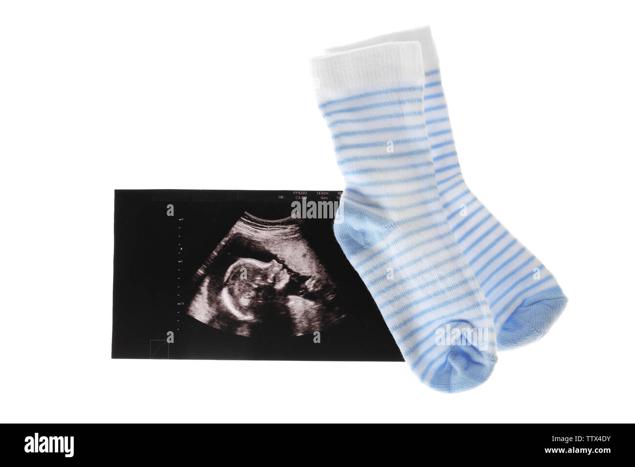 Ultrasound picture of baby and children socks on white background Stock ...