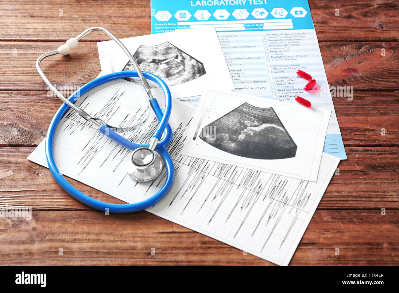 Ultrasound scan of baby with stethoscope and laboratory test on wooden ...