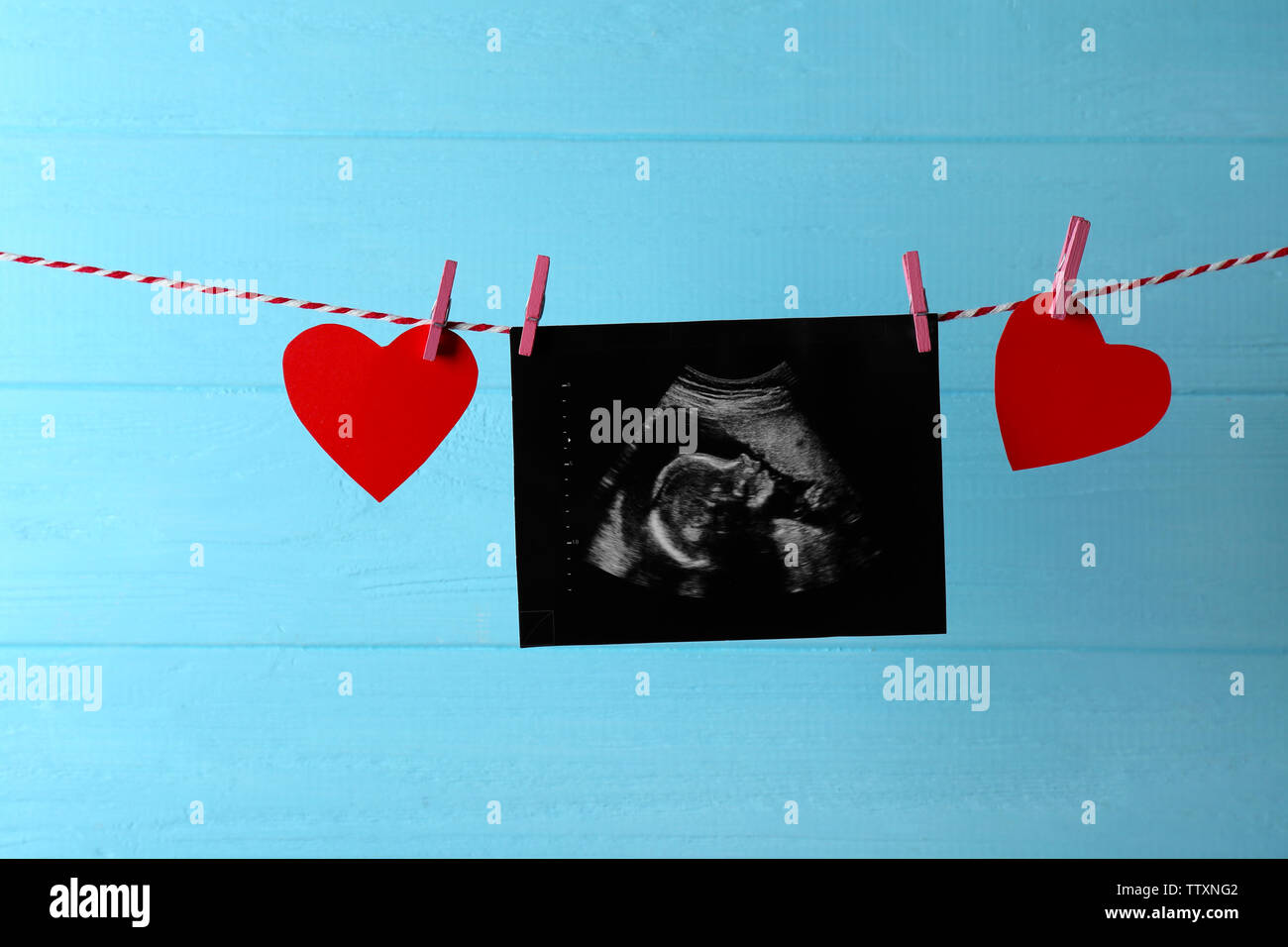 Ultrasound of baby hanging on rope Stock Photo - Alamy