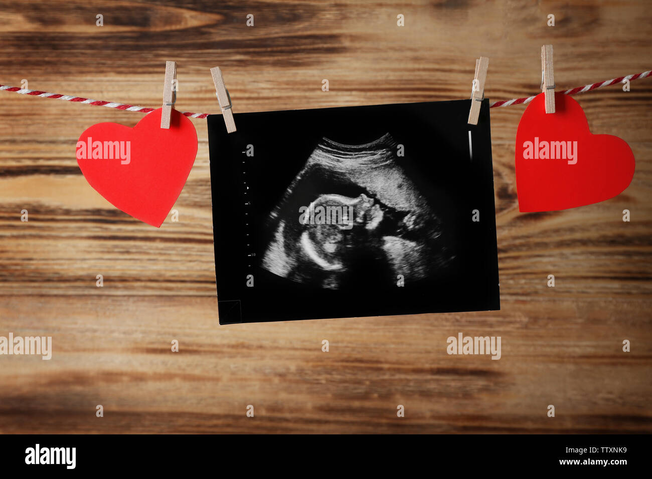 Ultrasound of baby hanging on rope Stock Photo - Alamy