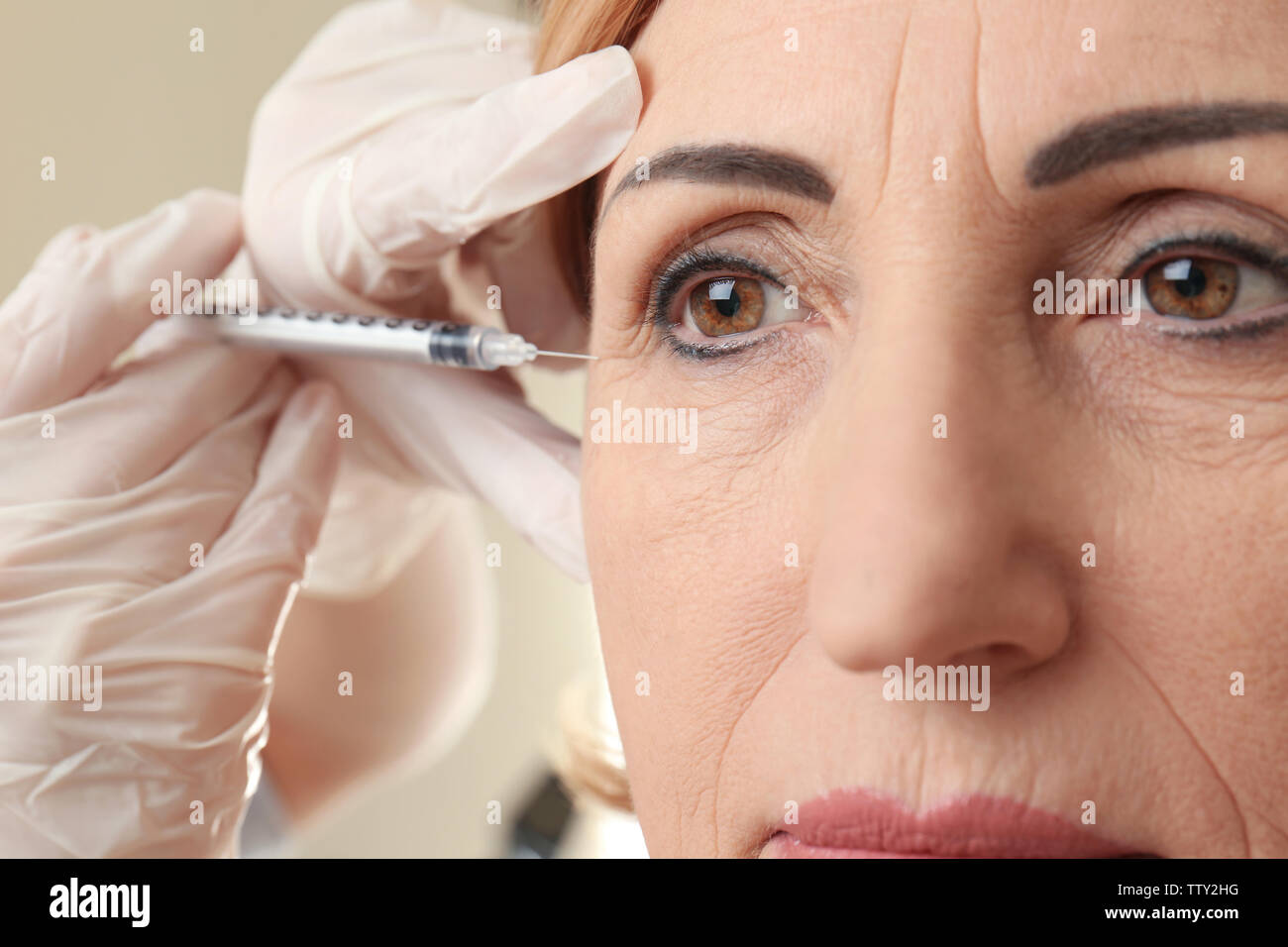 Hyaluronic acid injection for facial rejuvenation procedure Stock Photo ...